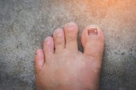 Why Do I Have Purple Toenails? | We Heart Nails